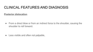 Shoulder and sprain.pptx................ | PPTX