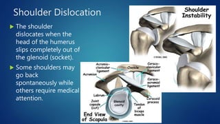 Shoulder Arthritis | Shoulder Instability | South Windsor, Rocky Hill ...