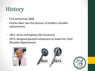 Shoulder arthroplasty - Basic information about shoulder replacement ...