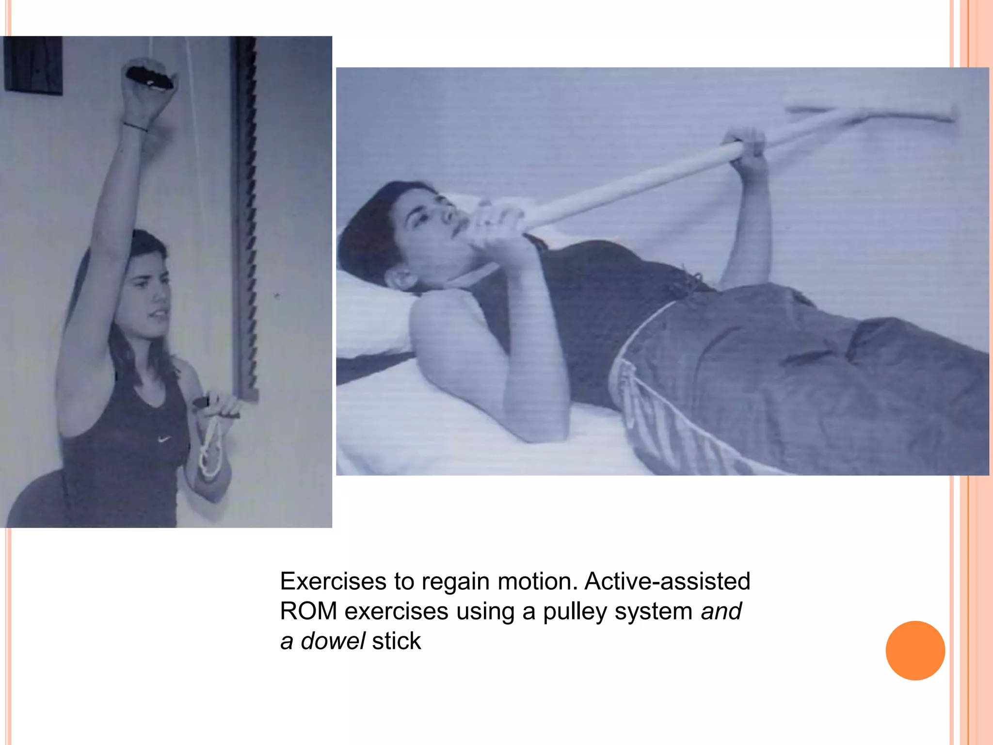 Shoulder arthroplasty & Physiotherapy | PPTX