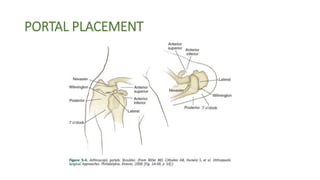 Shoulder arthroscopy | PPTX