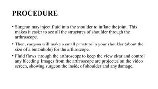 Shoulder Arthroscopy : Procedure.pptx