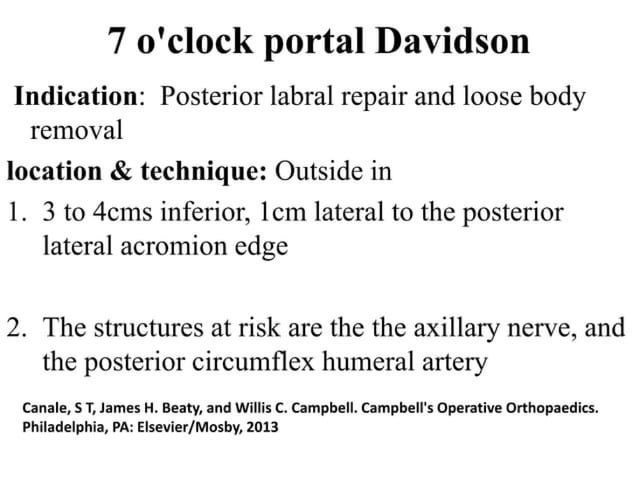 Shoulder arthroscopy portals presentation.pptx