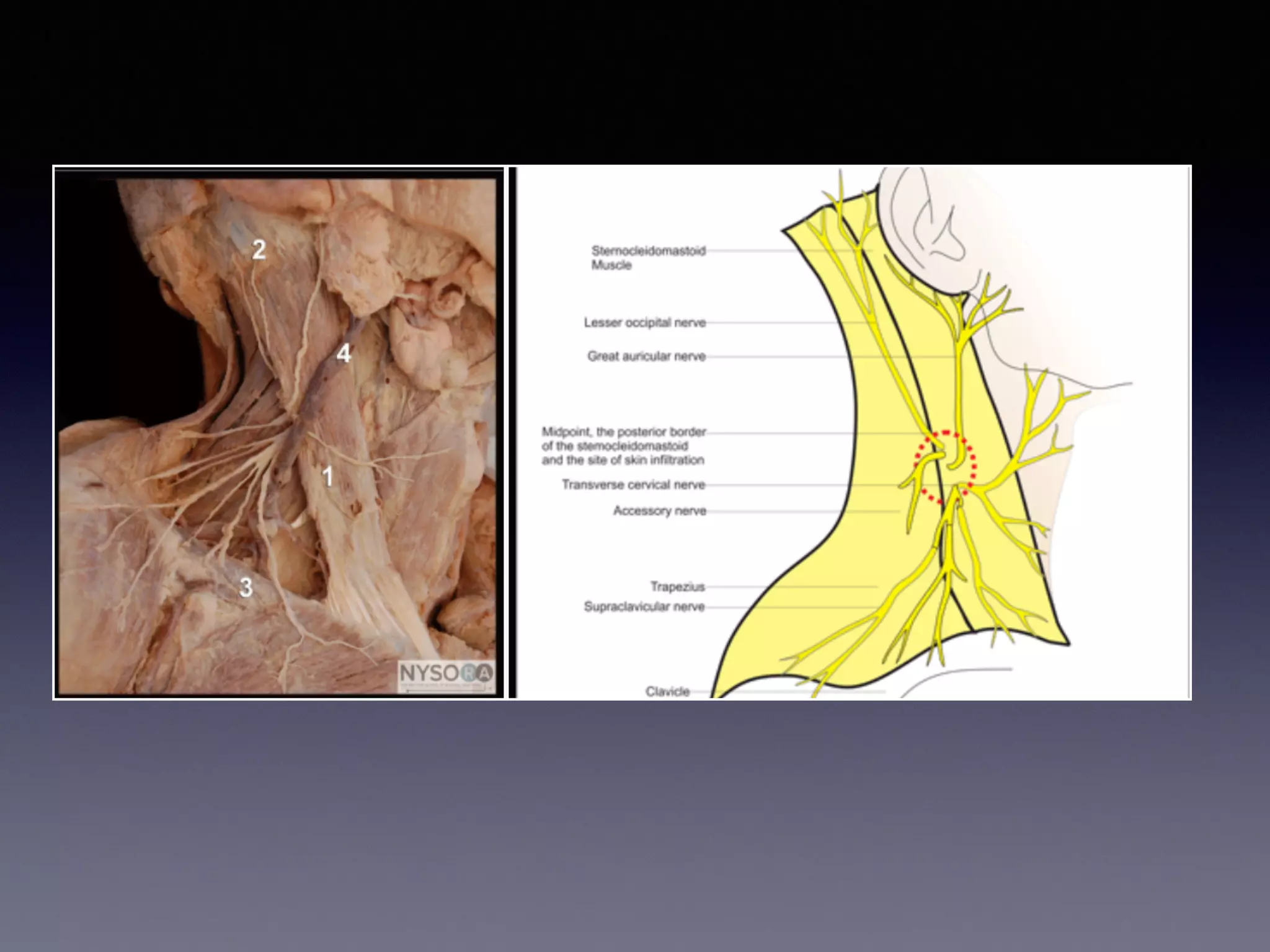 Shoulder block tutorial 2014 | PPT | Free Download