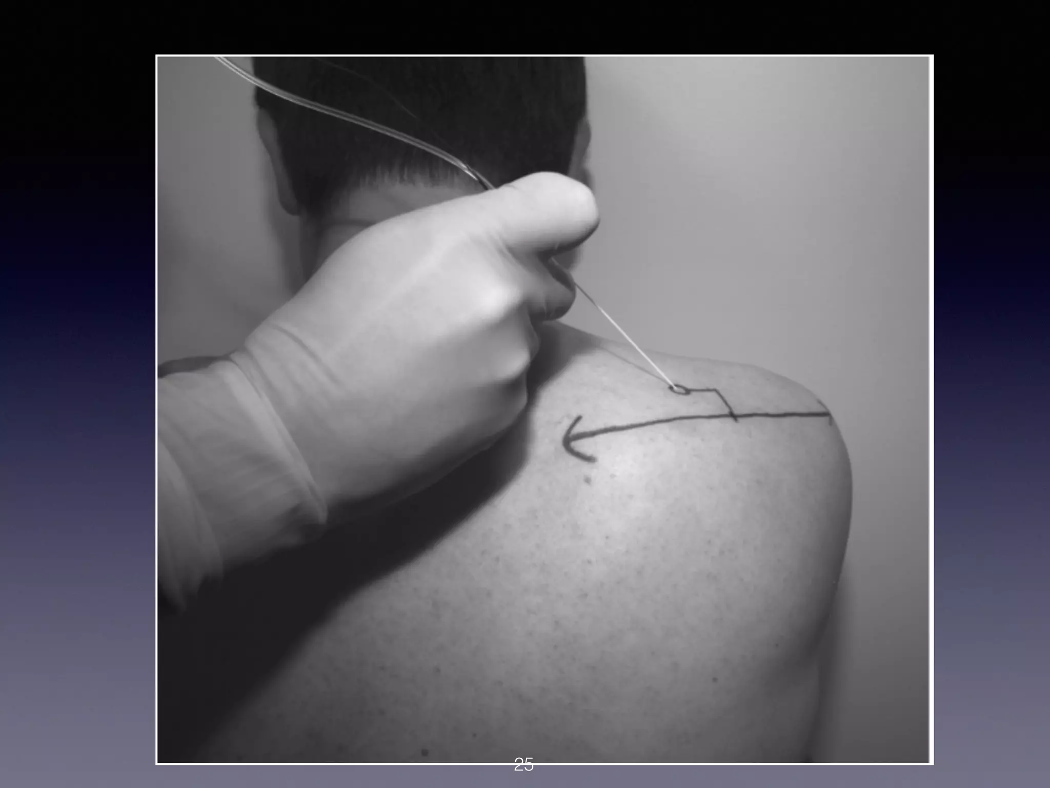 Shoulder block tutorial 2014 | PPT