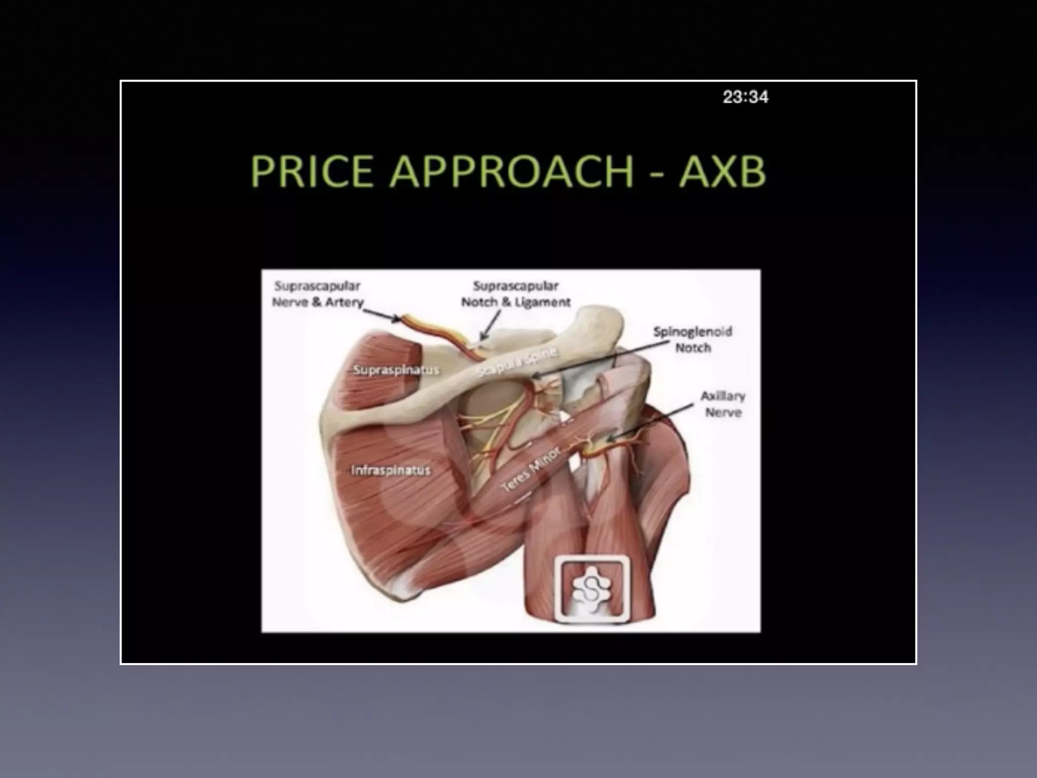 Shoulder block tutorial 2014 | PPT