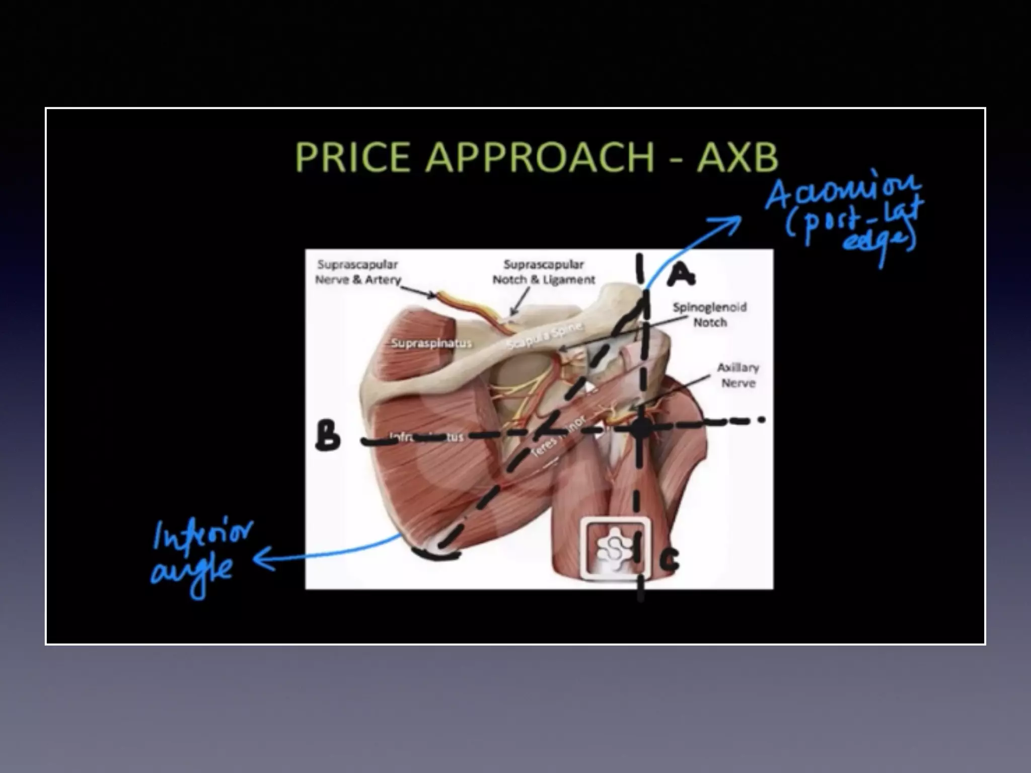 Shoulder block tutorial 2014 | PPT