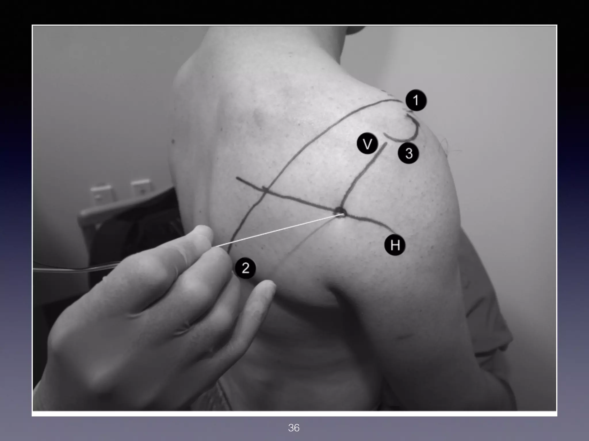 Shoulder block tutorial 2014 | PPT