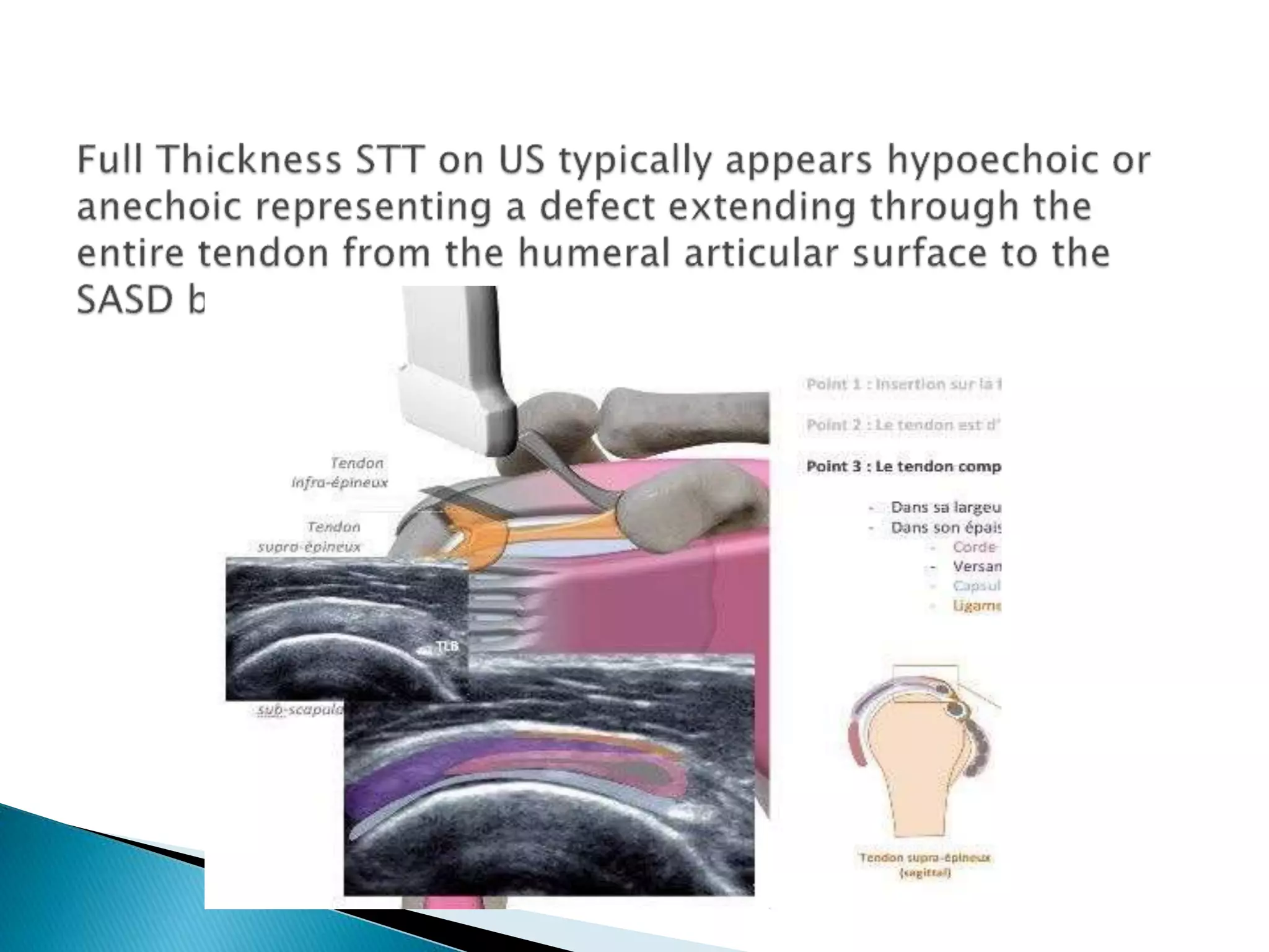 Shoulder Diagnostic Ultrasound.pptx
