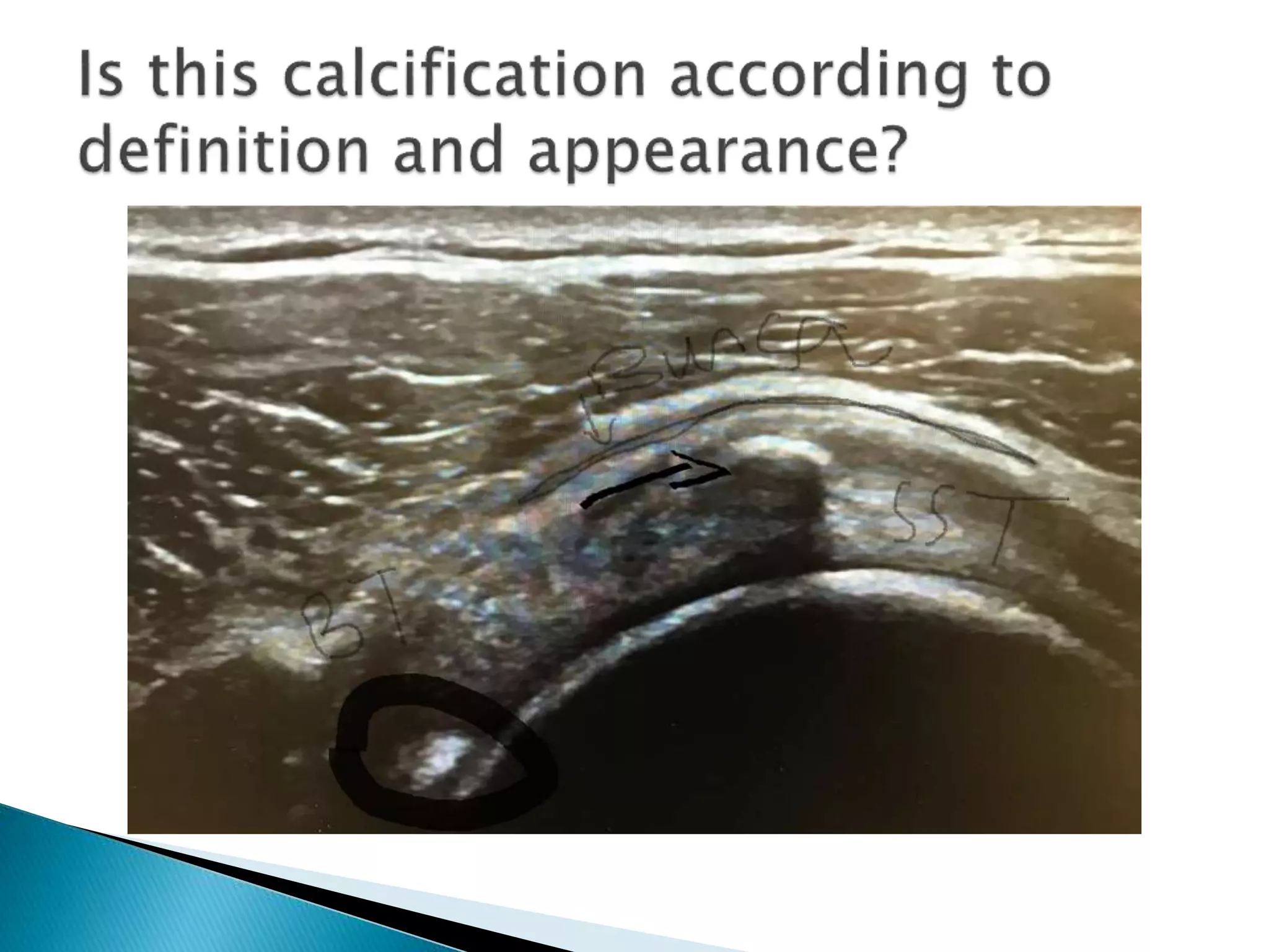 Shoulder Diagnostic Ultrasound.pptx