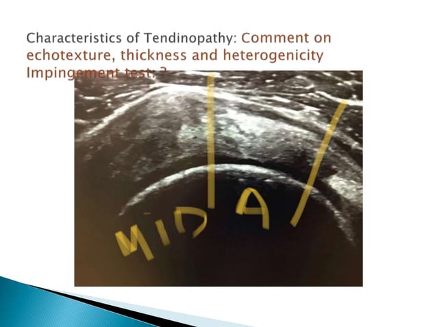 Shoulder Diagnostic Ultrasound.pptx