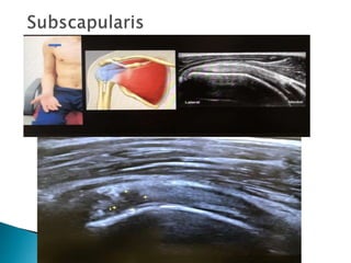 Shoulder Diagnostic Ultrasound.pptx