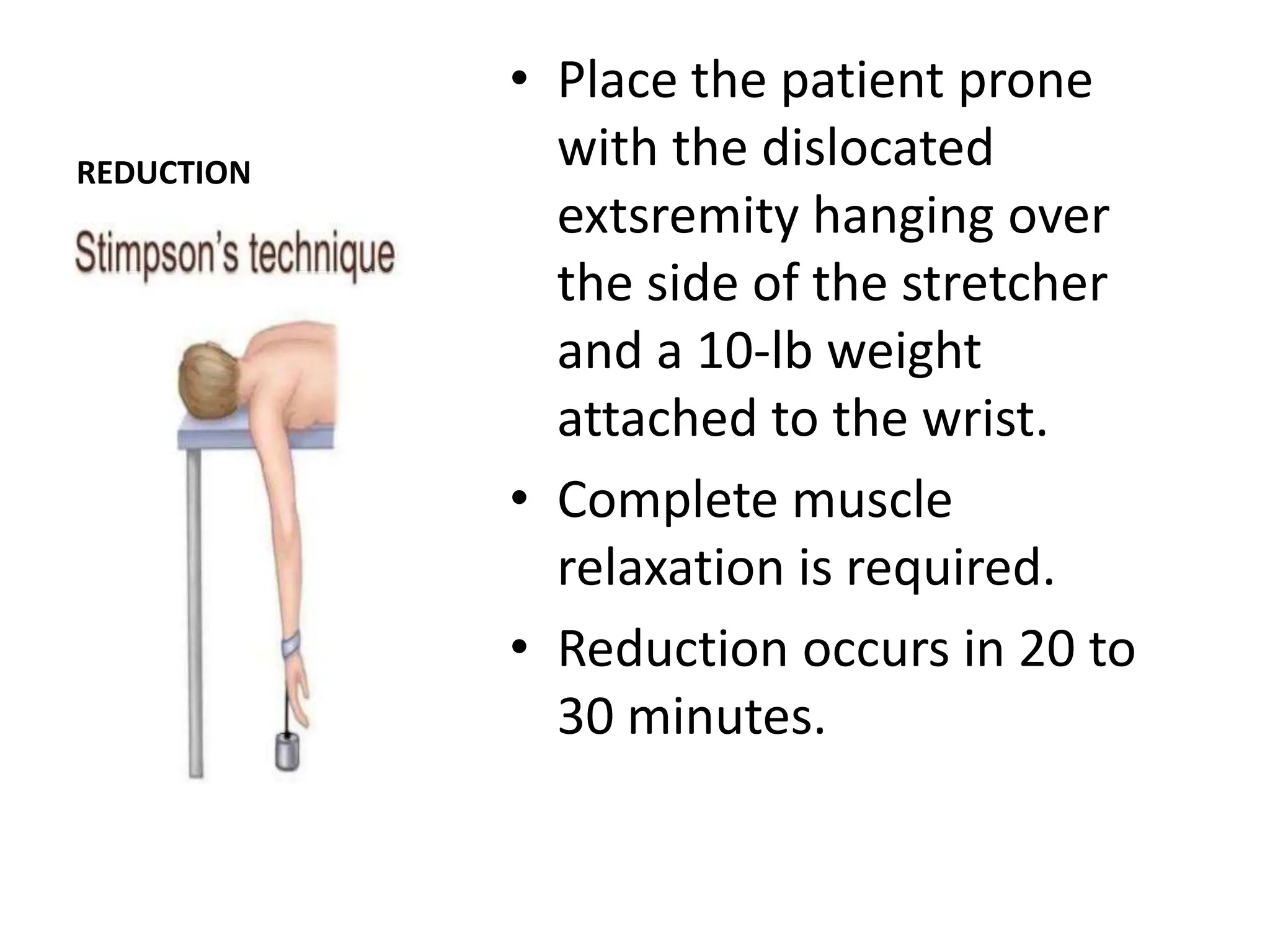 SHOULDER DISLOCTION FOR HOMOEOPATHIC (SURGERY) | PPTX