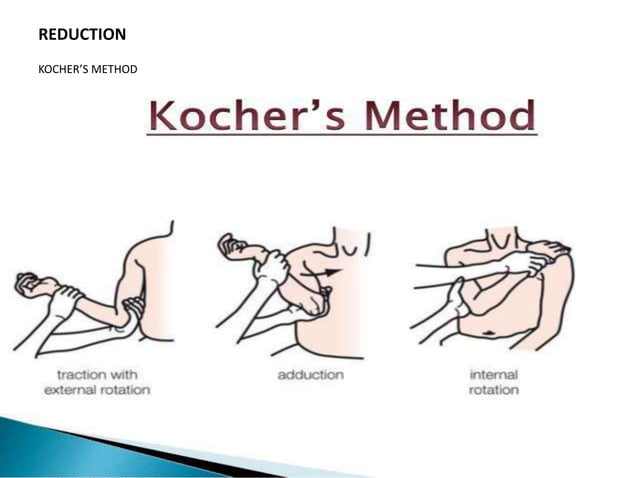 SHOULDER DISLOCTION FOR HOMOEOPATHIC (SURGERY) | PPT