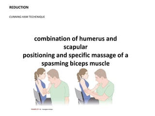 SHOULDER DISLOCTION FOR HOMOEOPATHIC (SURGERY) | PPTX