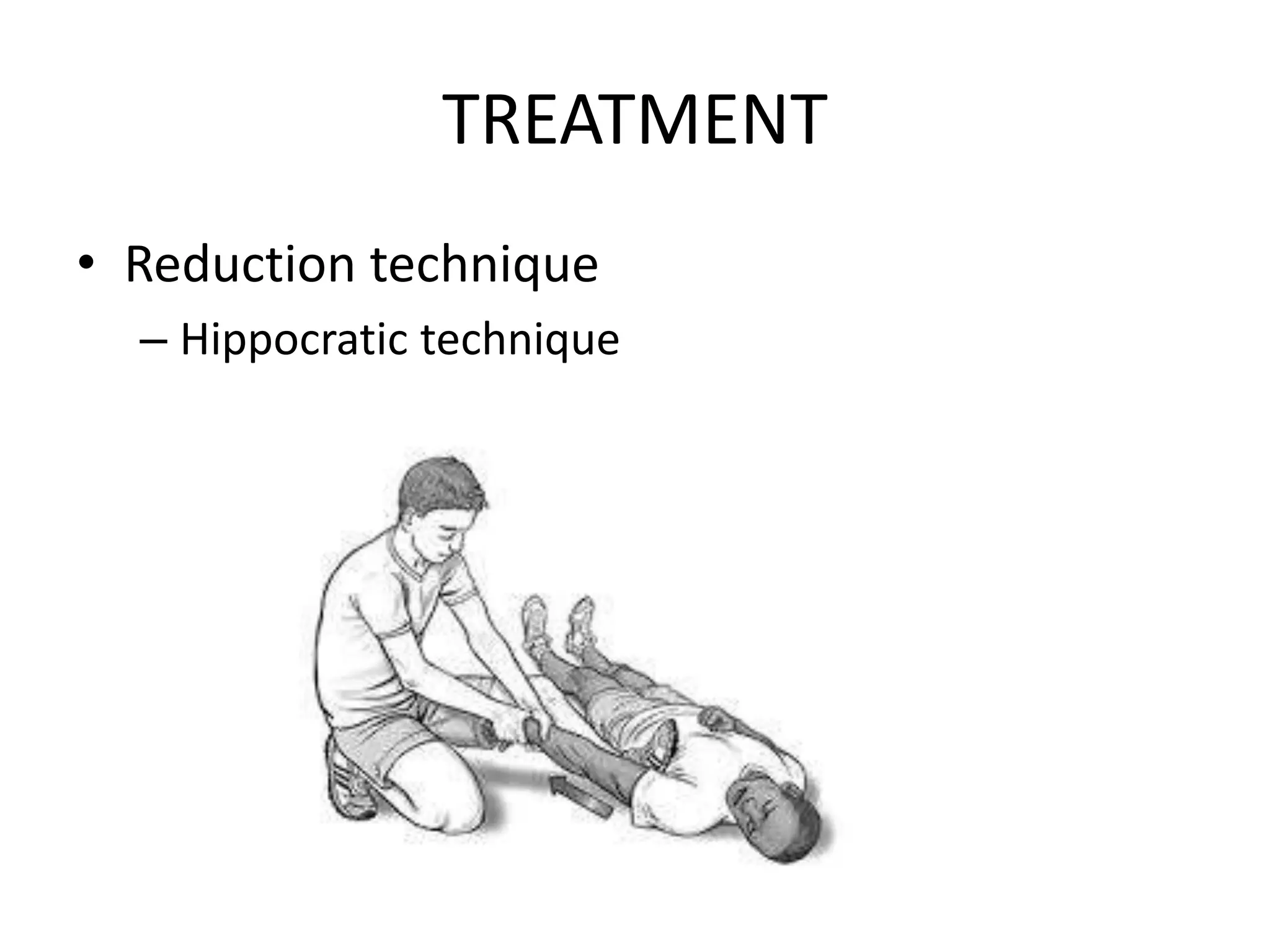 Shoulder disloaction | PPTX