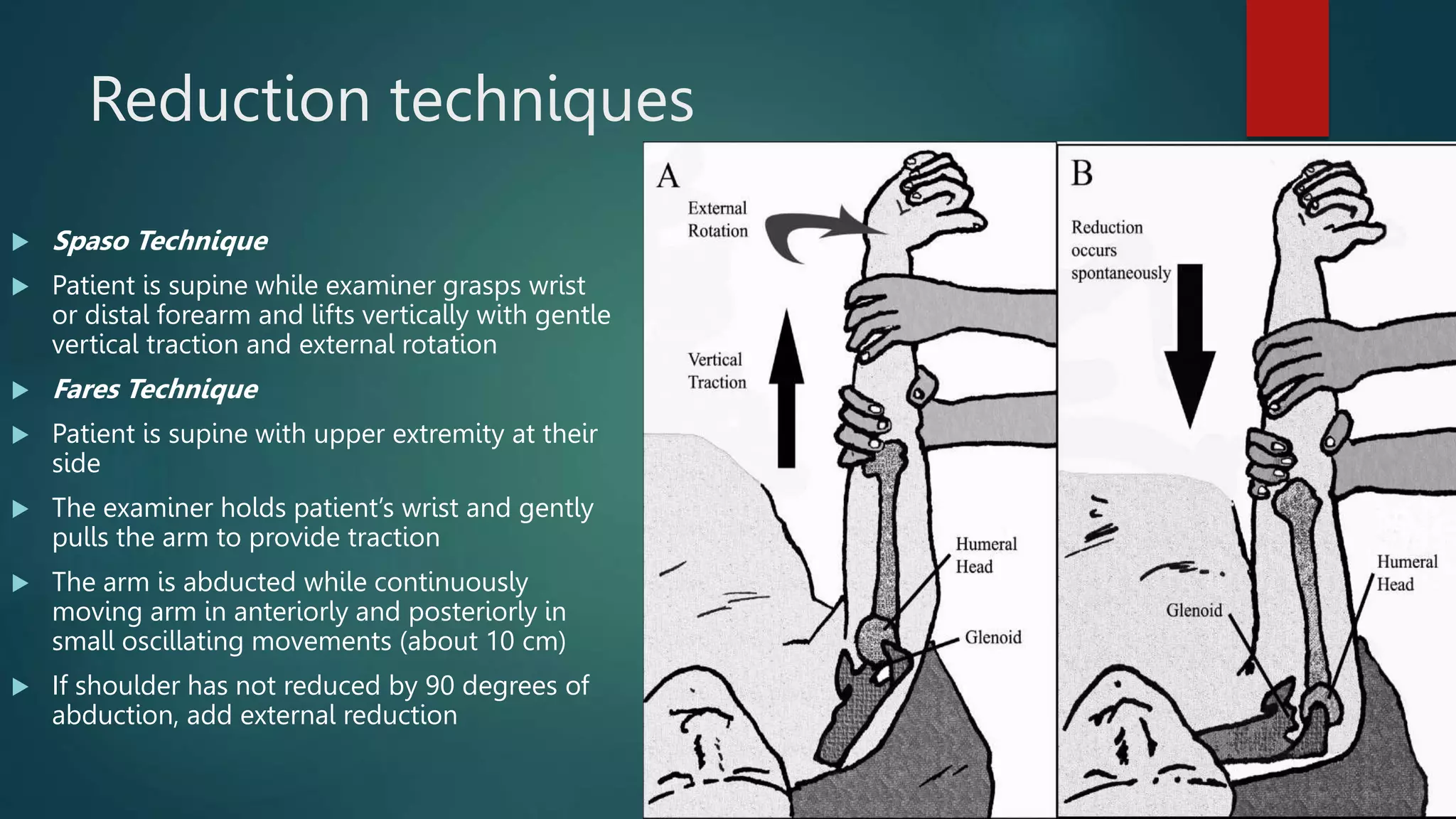 SHOULDER DISLOCATION-1.pptx