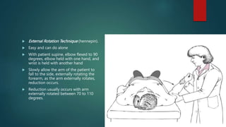 SHOULDER DISLOCATION-1.pptx