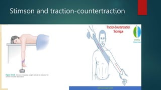 SHOULDER DISLOCATION-1.pptx