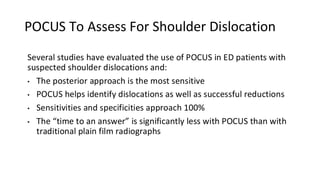 Shoulder Dislocations - Orthopedic Radiologic Imaging | PDF