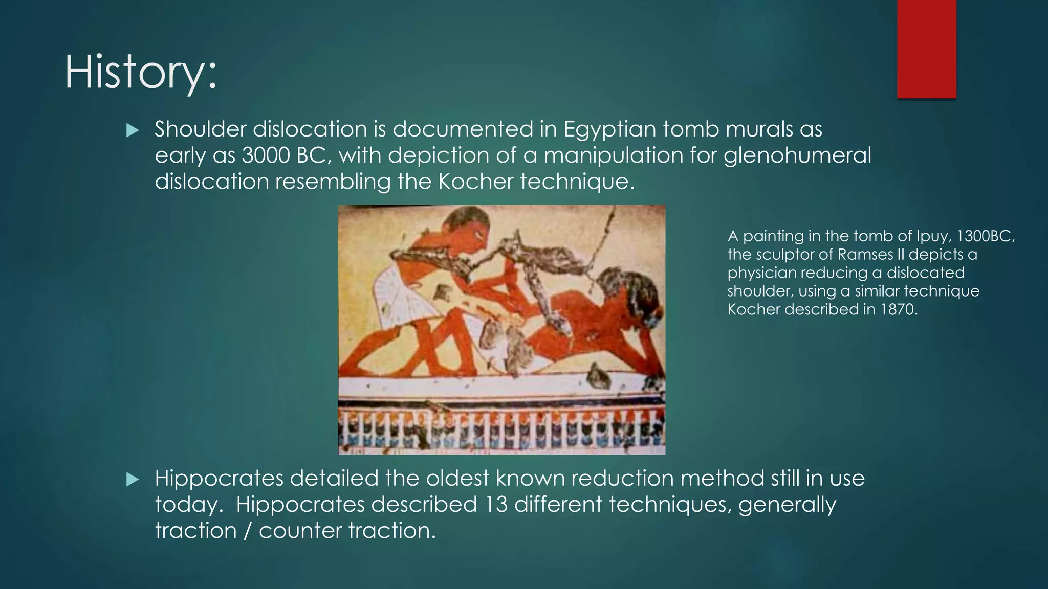 Shoulder dislocation | PPTX