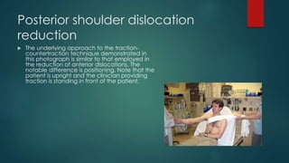 Shoulder dislocation | PPT