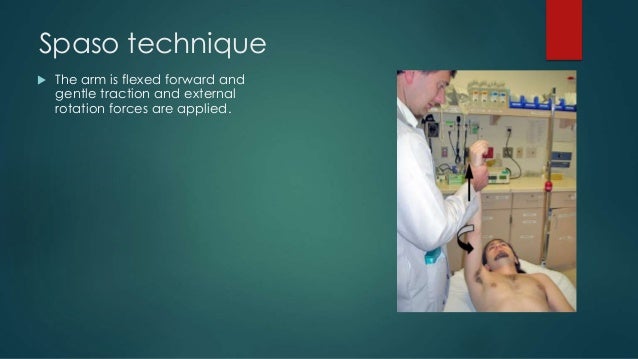 Shoulder dislocation