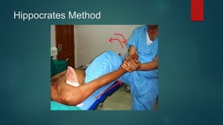 Shoulder dislocation- M.B.B.S | PPTX