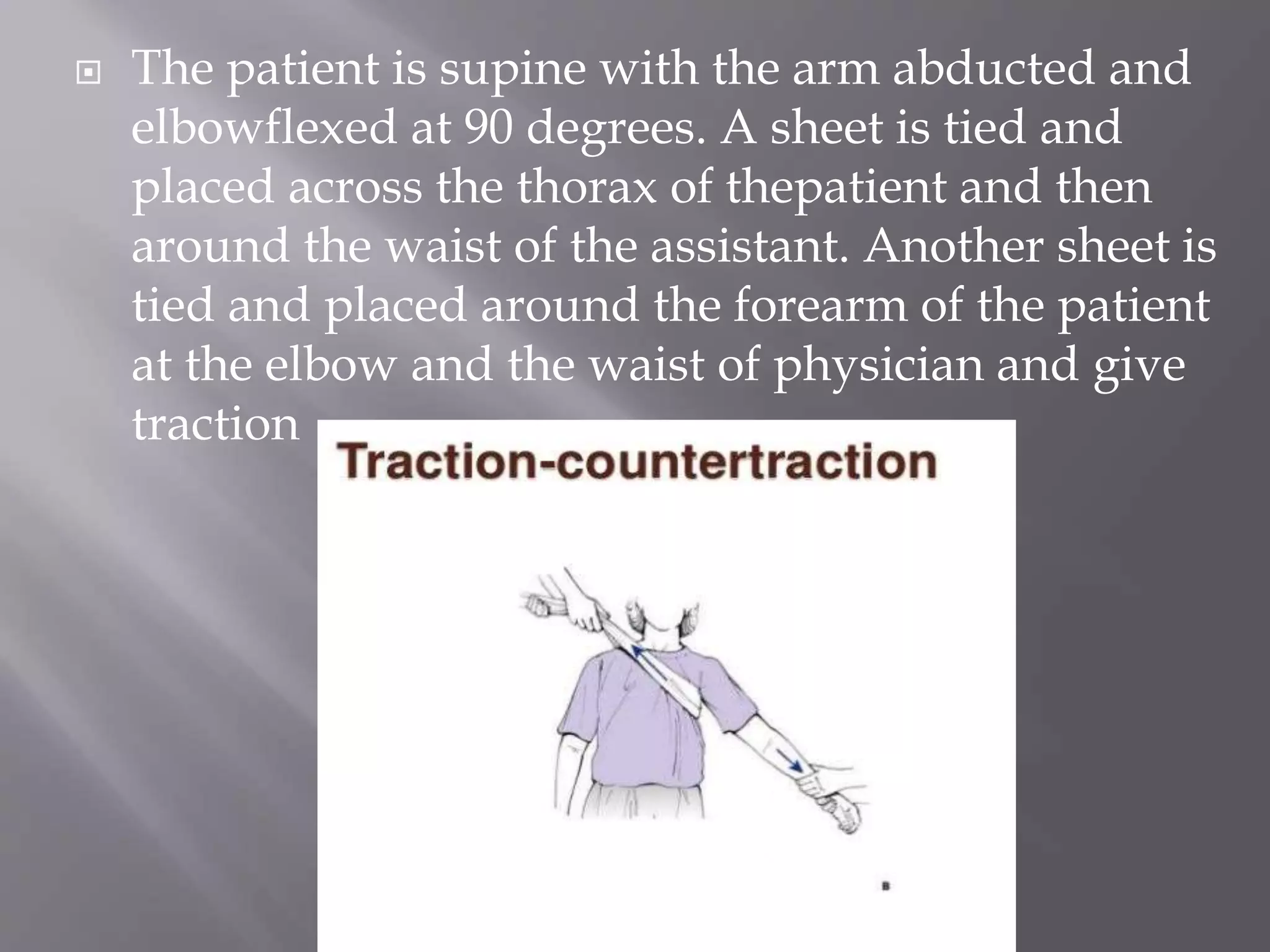 Shoulder dislocation | PPTX