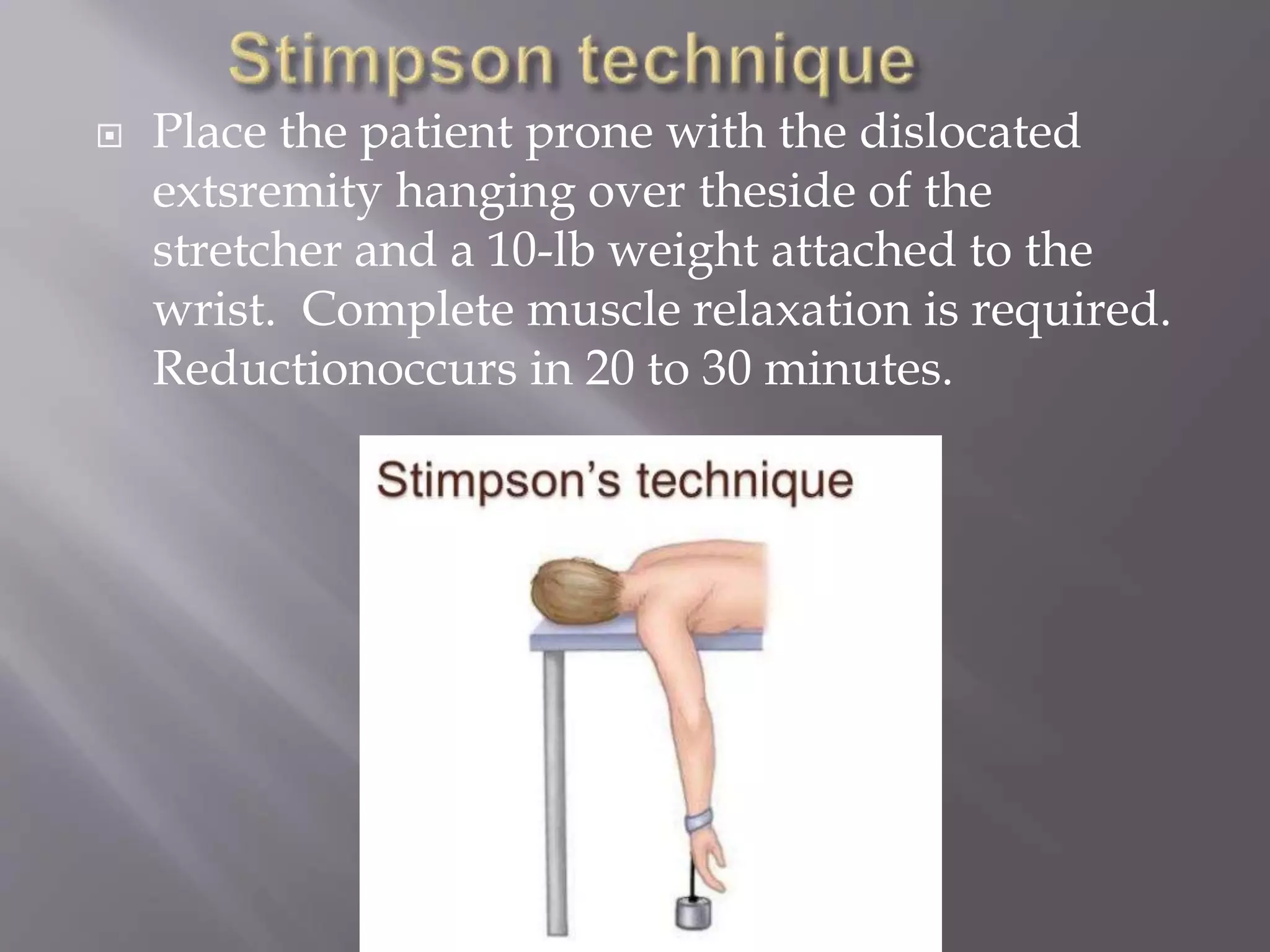 Shoulder dislocation | PPTX