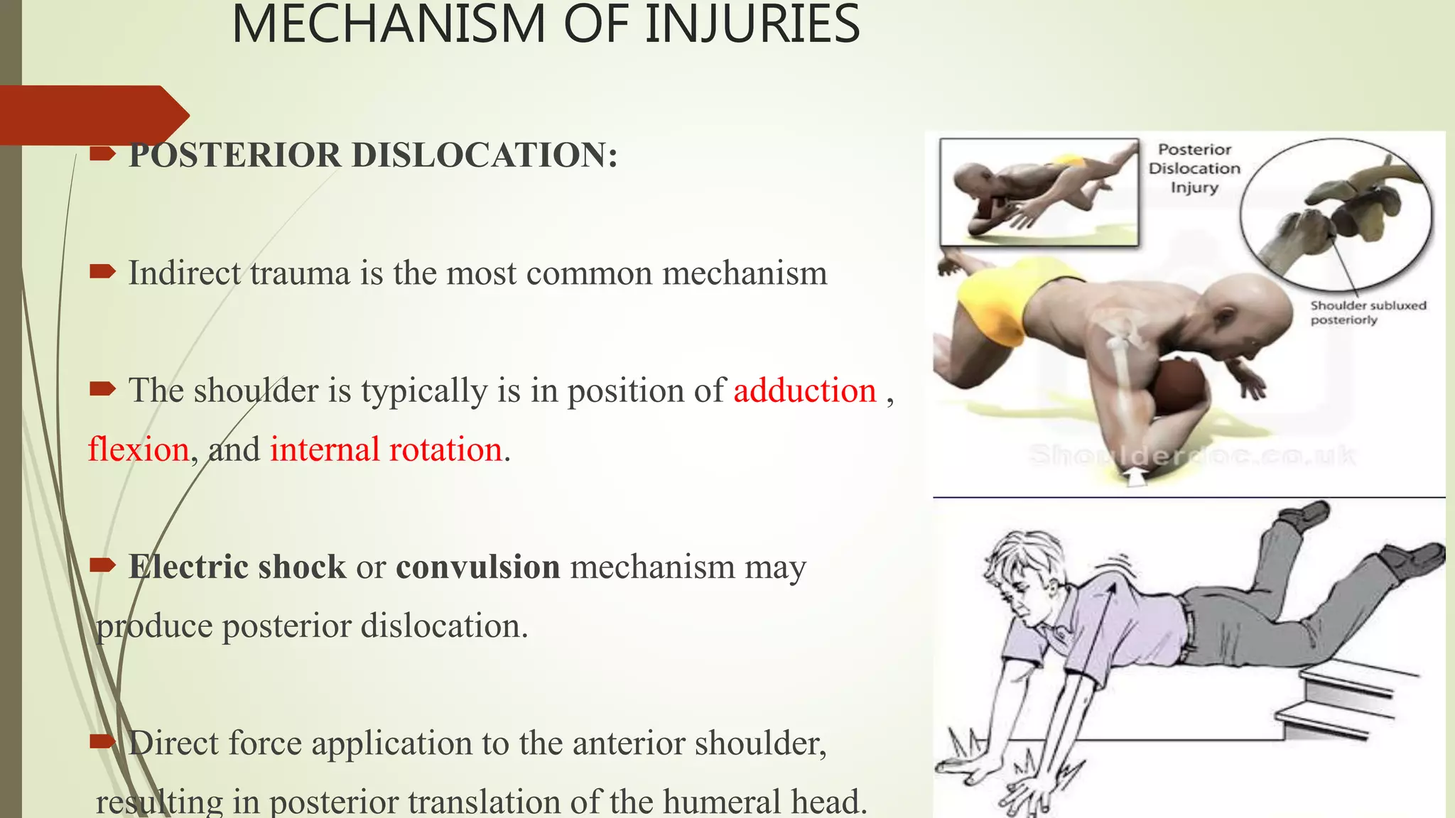 Shoulder dislocation | PPTX