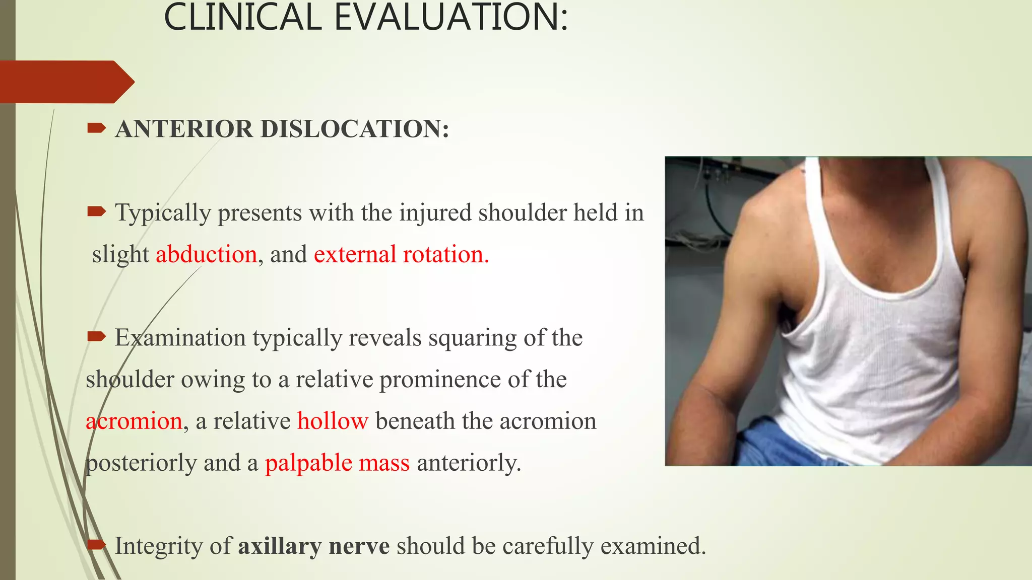 Shoulder dislocation | PPTX
