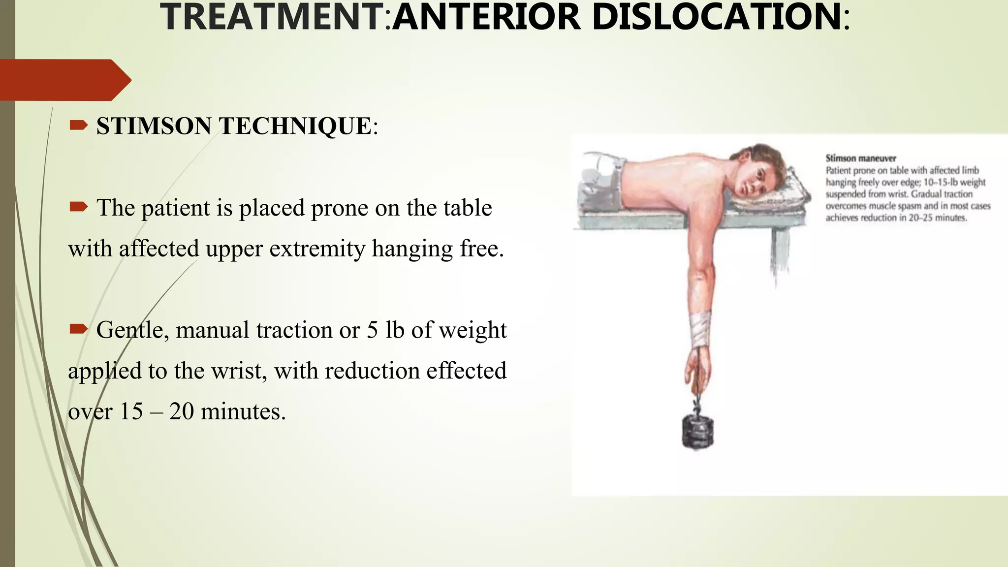 Shoulder dislocation | PPTX