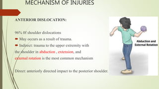 Anterior Shoulder Dislocation Mechanism Of Injury