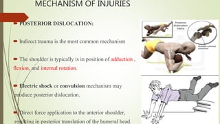 Anterior Shoulder Dislocation Mechanism Of Injury