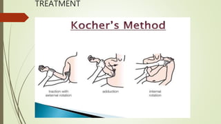 Medicowesome: Reduction Of Anterior Dislocation Of Shoulder, 44% OFF