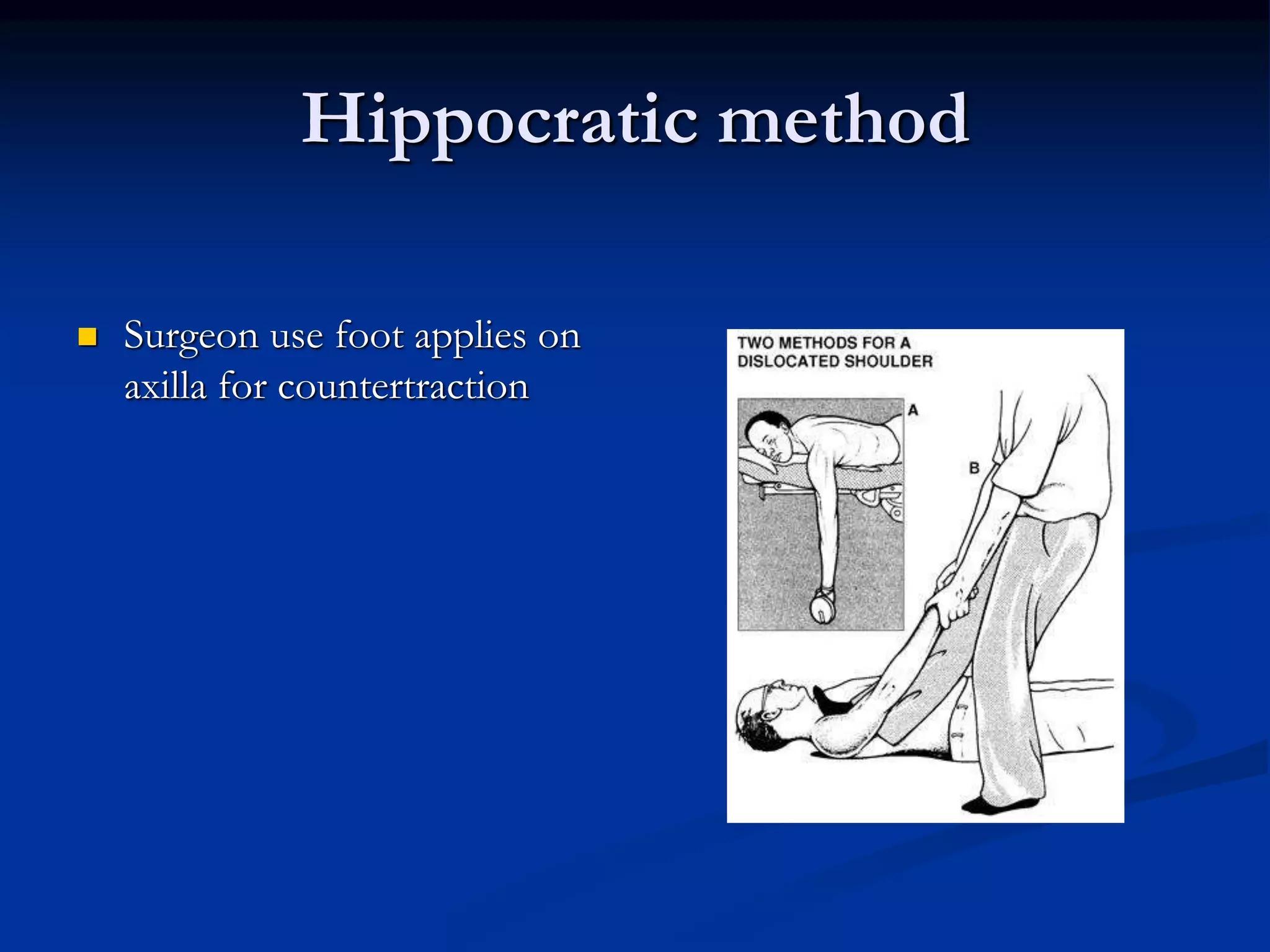 Shoulder_Dislocation.ppt