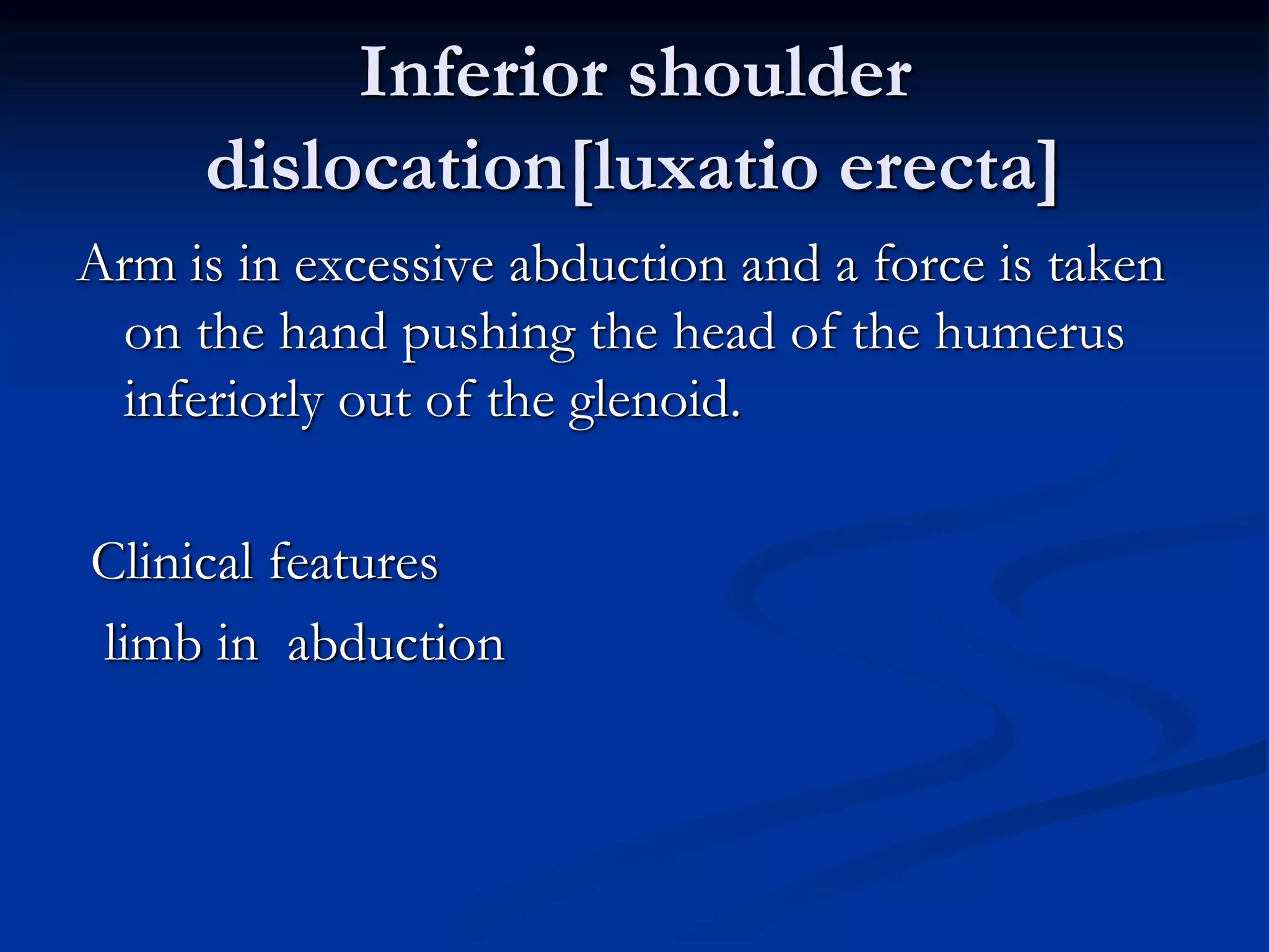 Shoulder_Dislocation.ppt