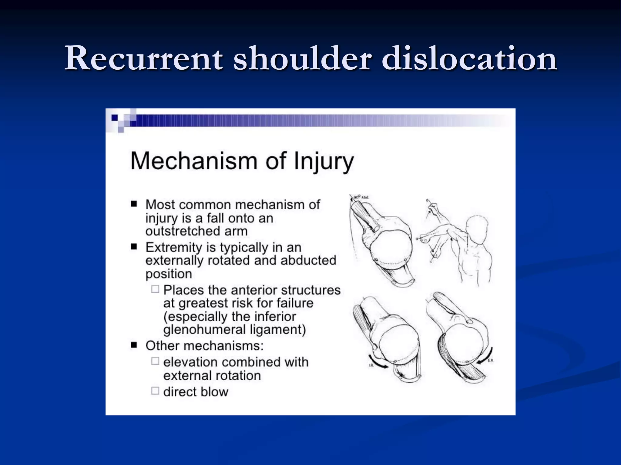 Shoulder_Dislocation.ppt