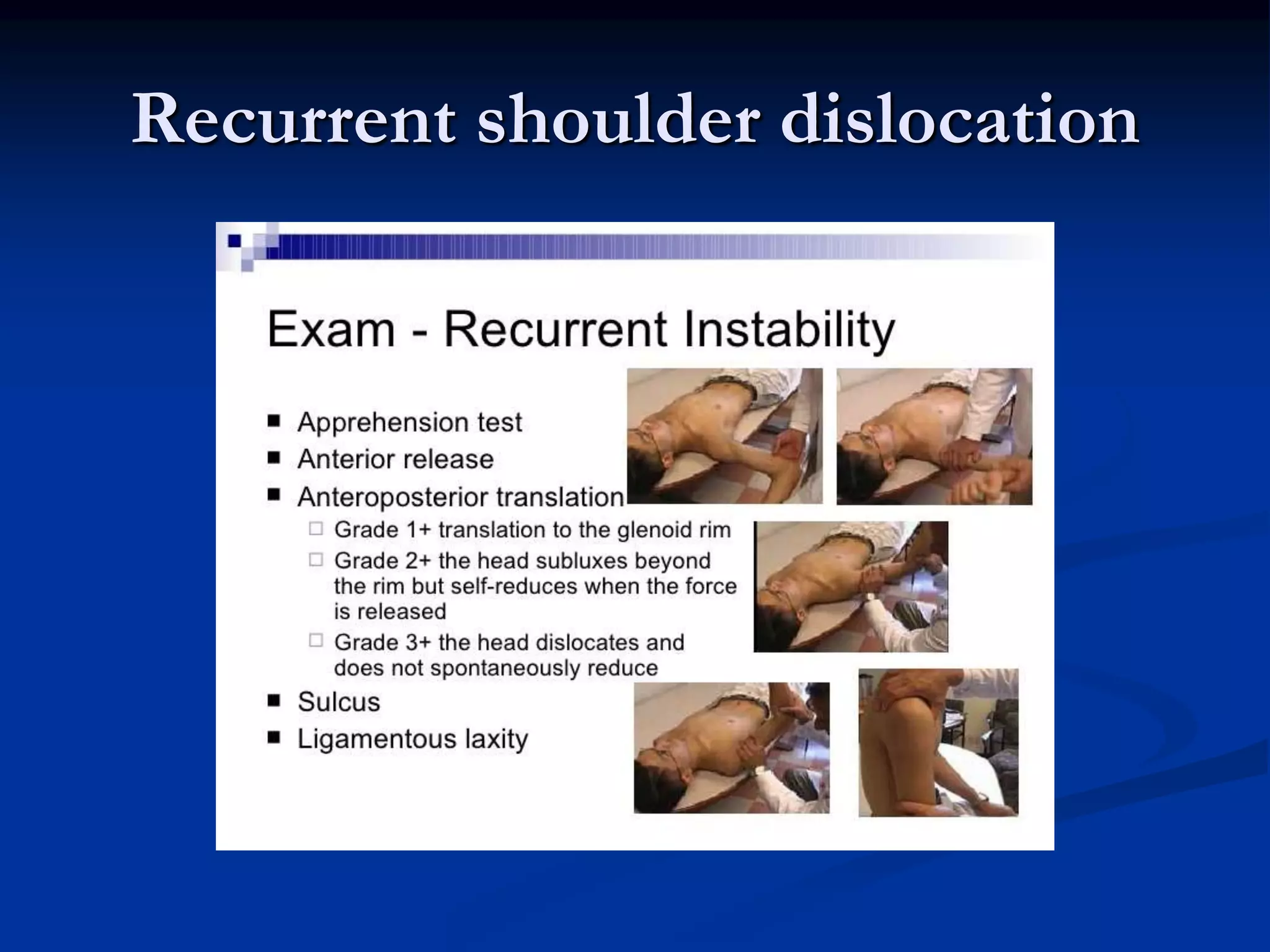 Shoulder_Dislocation.ppt