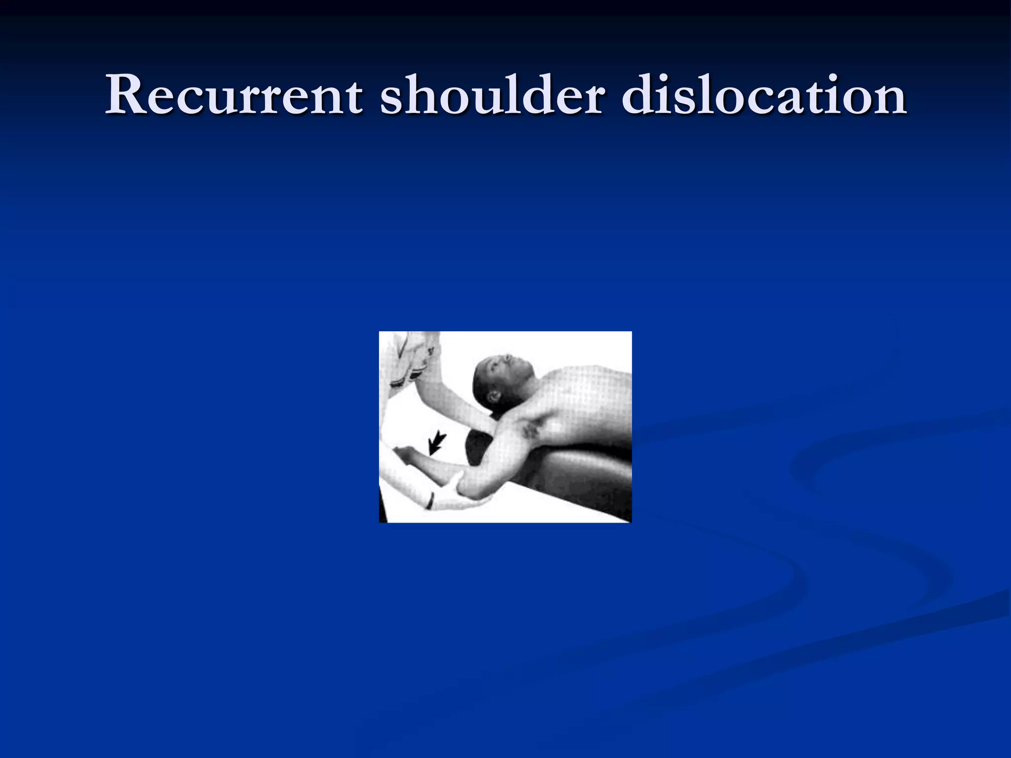 Shoulder_Dislocation.ppt