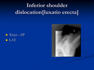 Shoulder_Dislocation.ppt