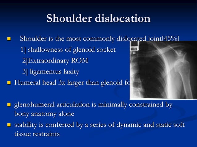 Shoulder_Dislocation.ppt