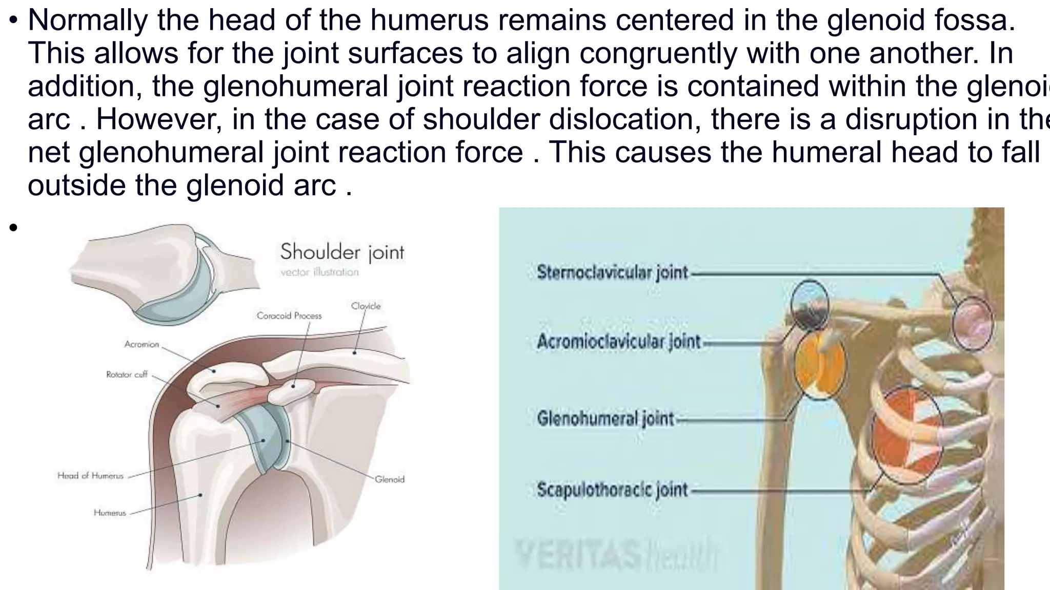 Shoulder dislocation.pptx