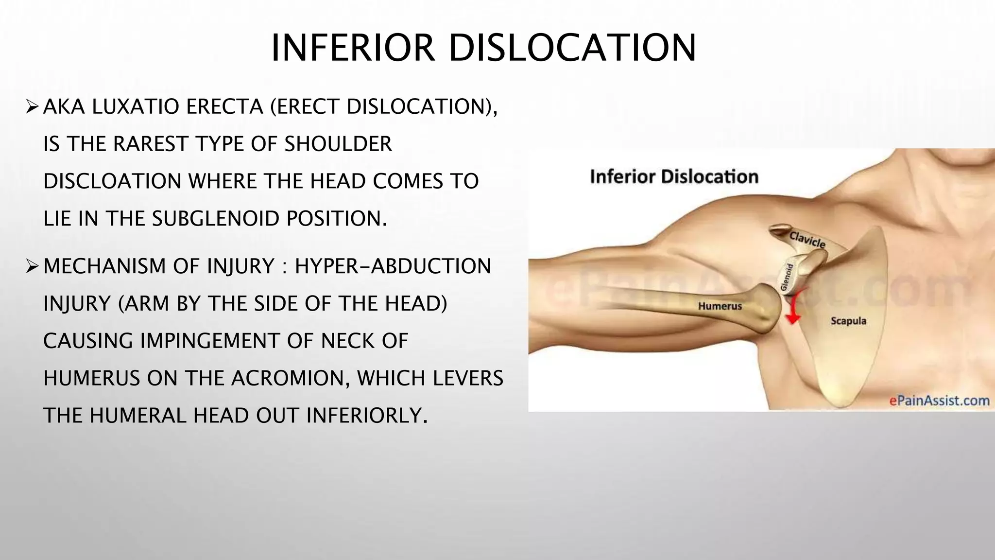 Shoulder dislocation.pptx