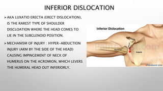 Shoulder dislocation.pptx