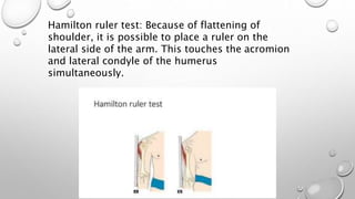Shoulder dislocation.pptx