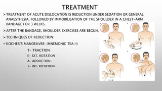 Kocher Maneuver Shoulder
