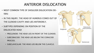 Shoulder dislocation.pptx