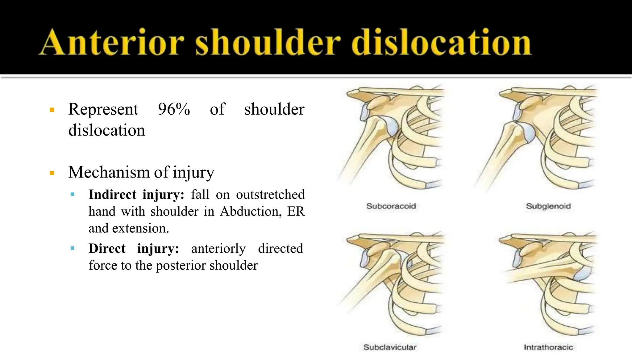 SHOULDER DISLOCATION - Types, Clinical Features | PPTX